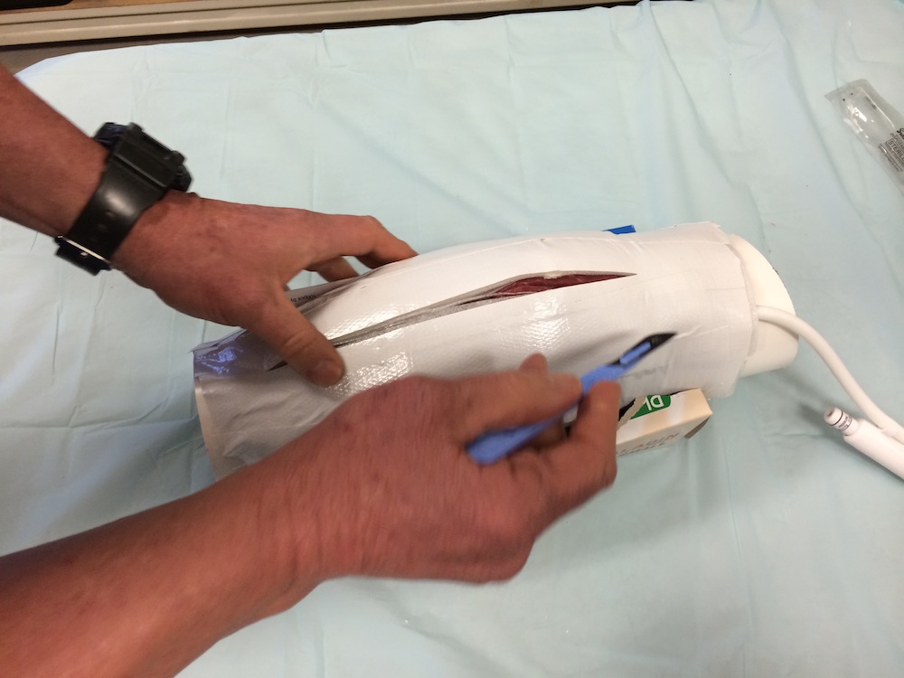 Escharotomy Model Mk II | Greater Sydney Area HEMS