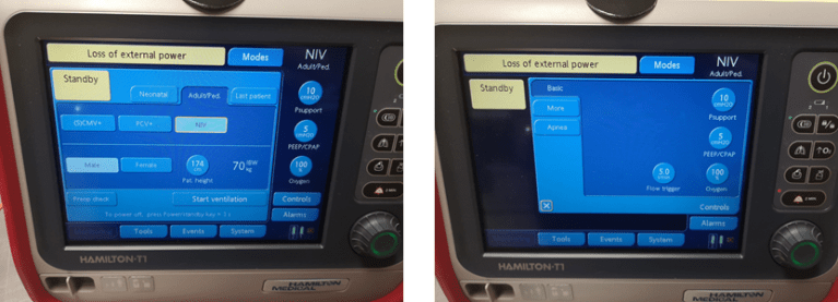 Getting the hang of the Hamilton Ventilator: | Greater Sydney Area HEMS